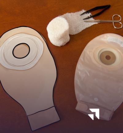 Understanding Bowel Ostomies | Activated Insights